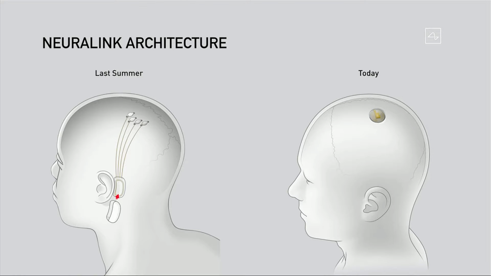 The Evolution of Medical Robots: A Historical Overview